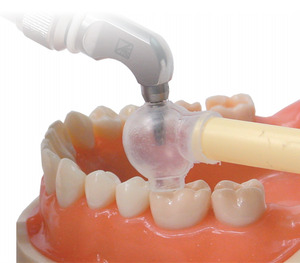 [이달의 제품(9월)] ㈜코덴 MicroEtcher IIA